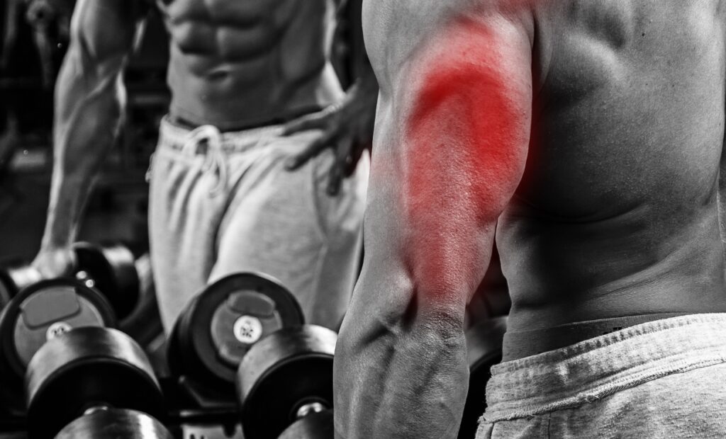 Treino de Tríceps completo para hipertrofia - Treino Mestre